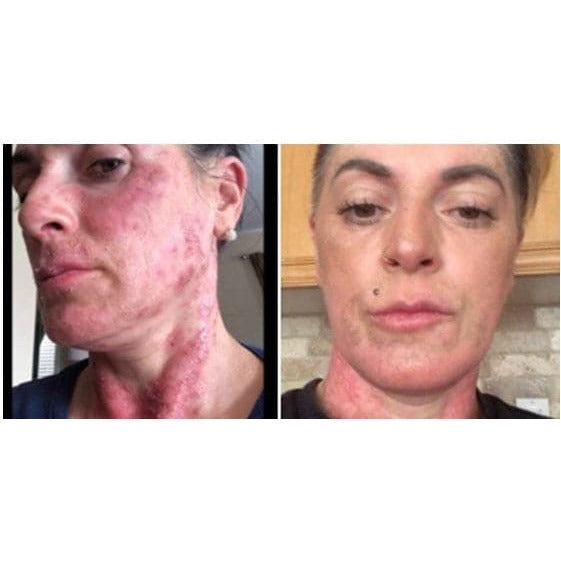 ION* Skin Support - 8oz spray – Revelation Health LLC