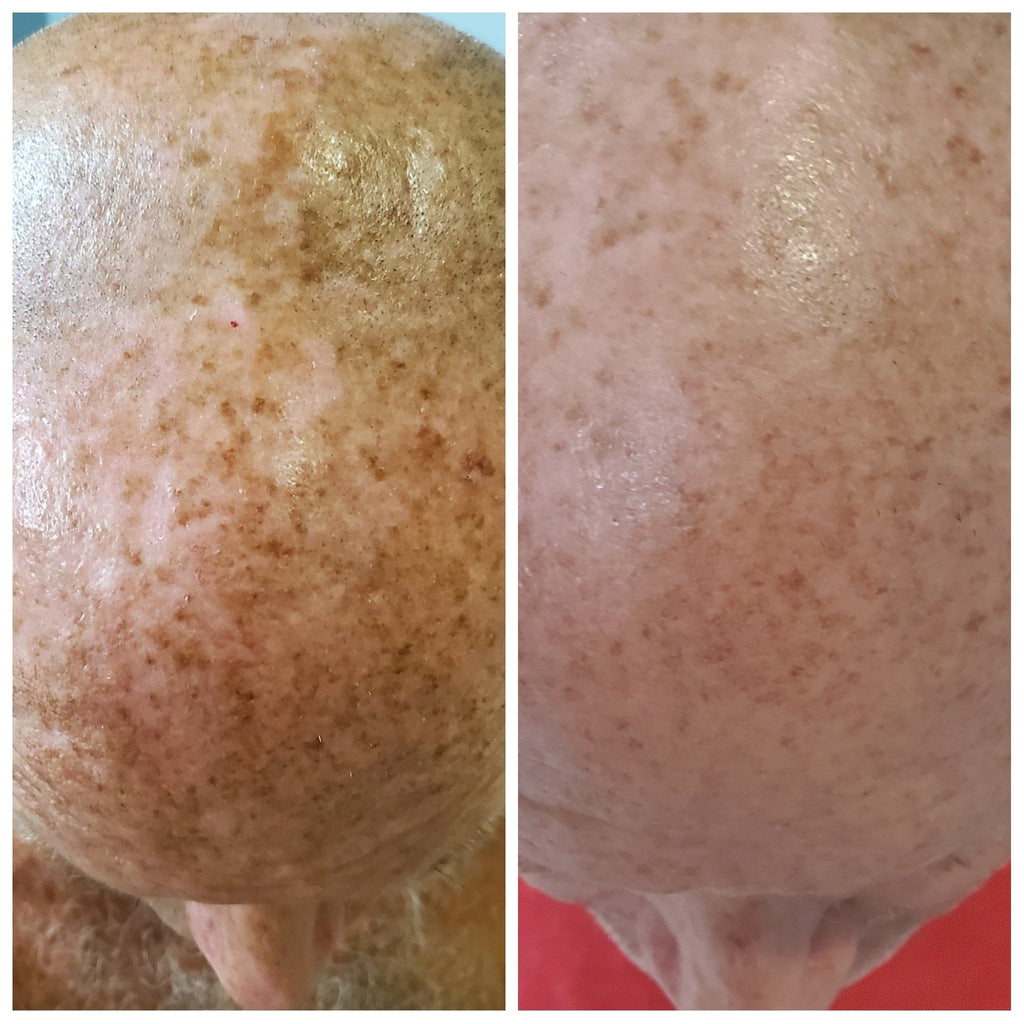 ION* Skin Support - 8oz spray – Revelation Health LLC